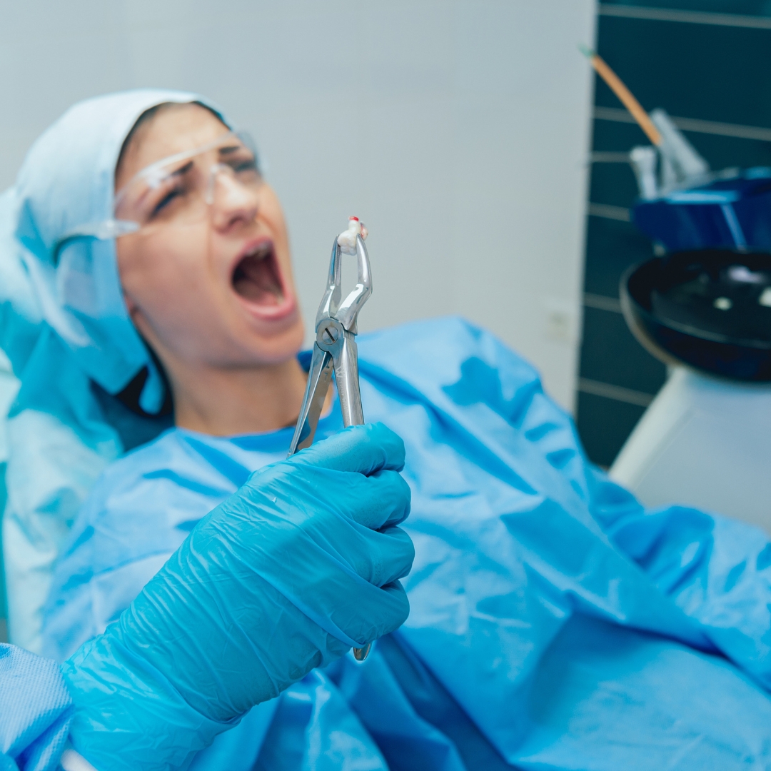 Wisdom Teeth Extraction and Oral Health: Long-Term Benefits ...